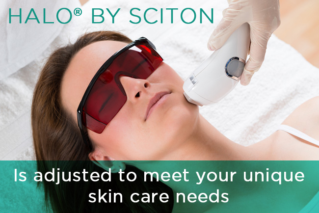 Best Procedures For 30's: Halo® By Sciton - Acqua Blu Medical Spa